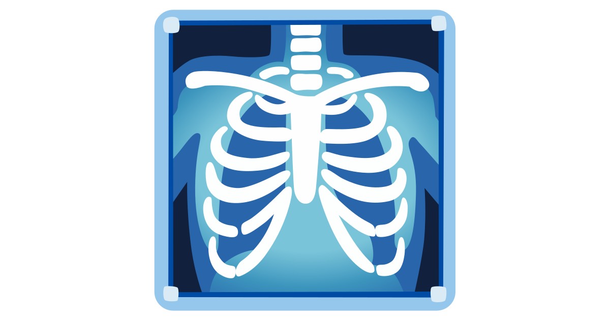 🩻 X-Ray Emoji