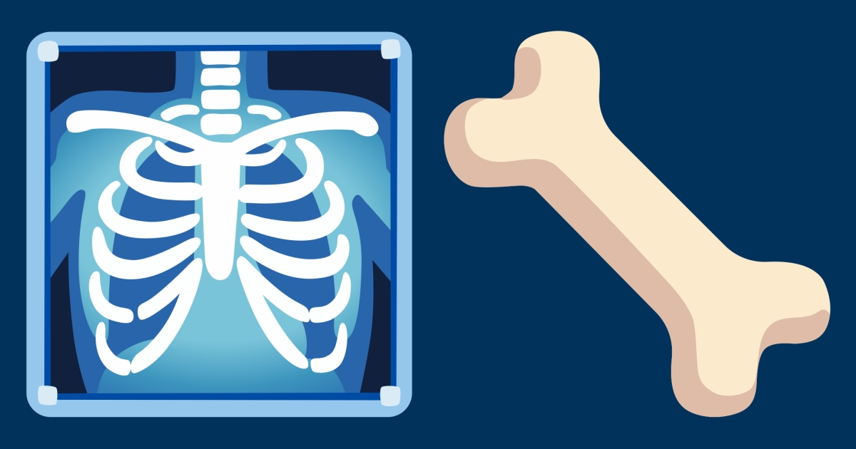 🦴 Bones Emojis 🩻