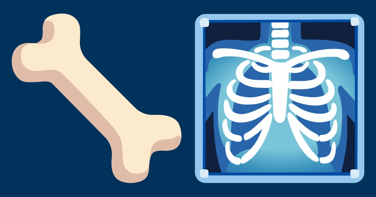 🦴 Skeleton Emojis 🩻